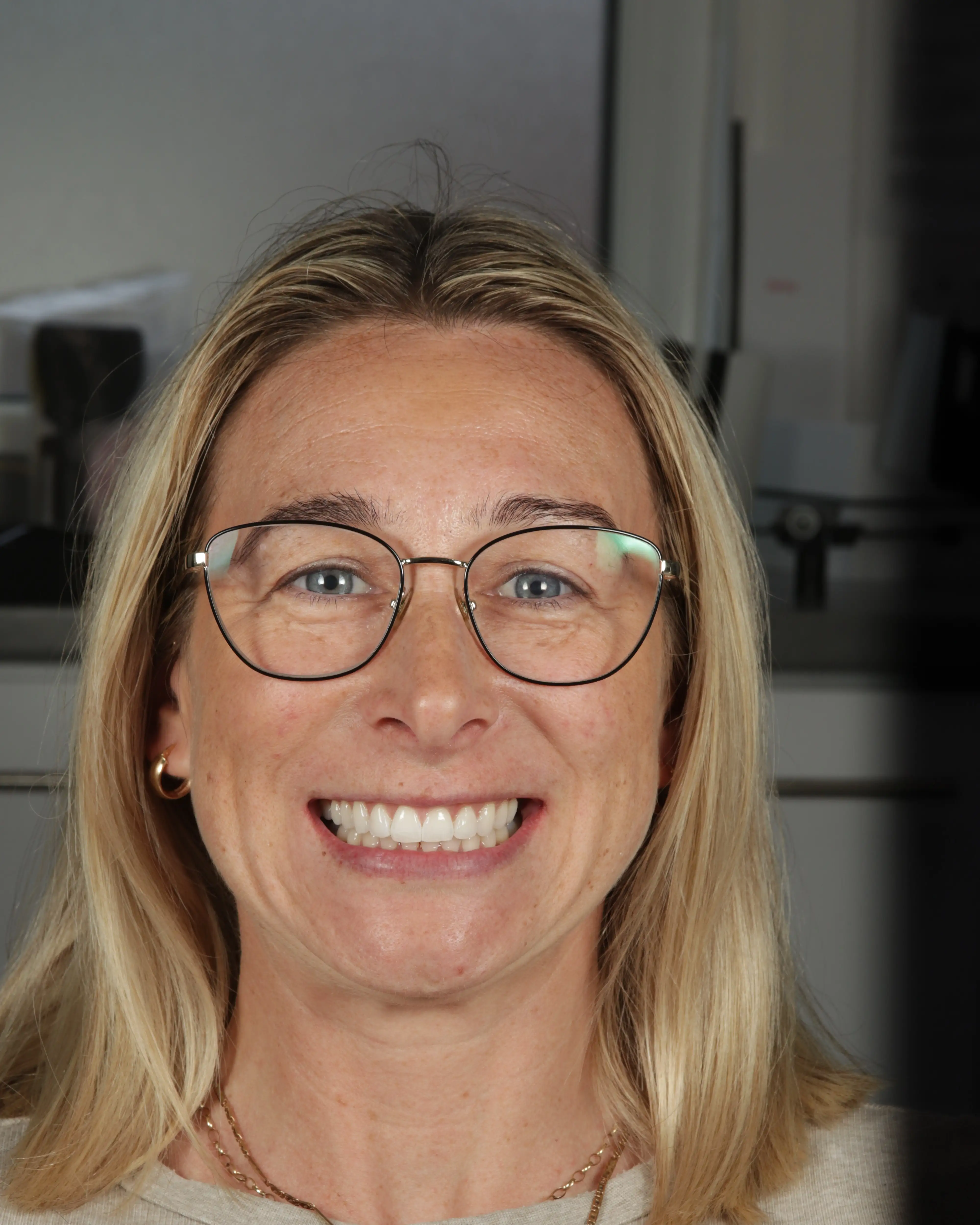 Alignar | Crafting Smiles with Teeth Straightening Clear Aligners